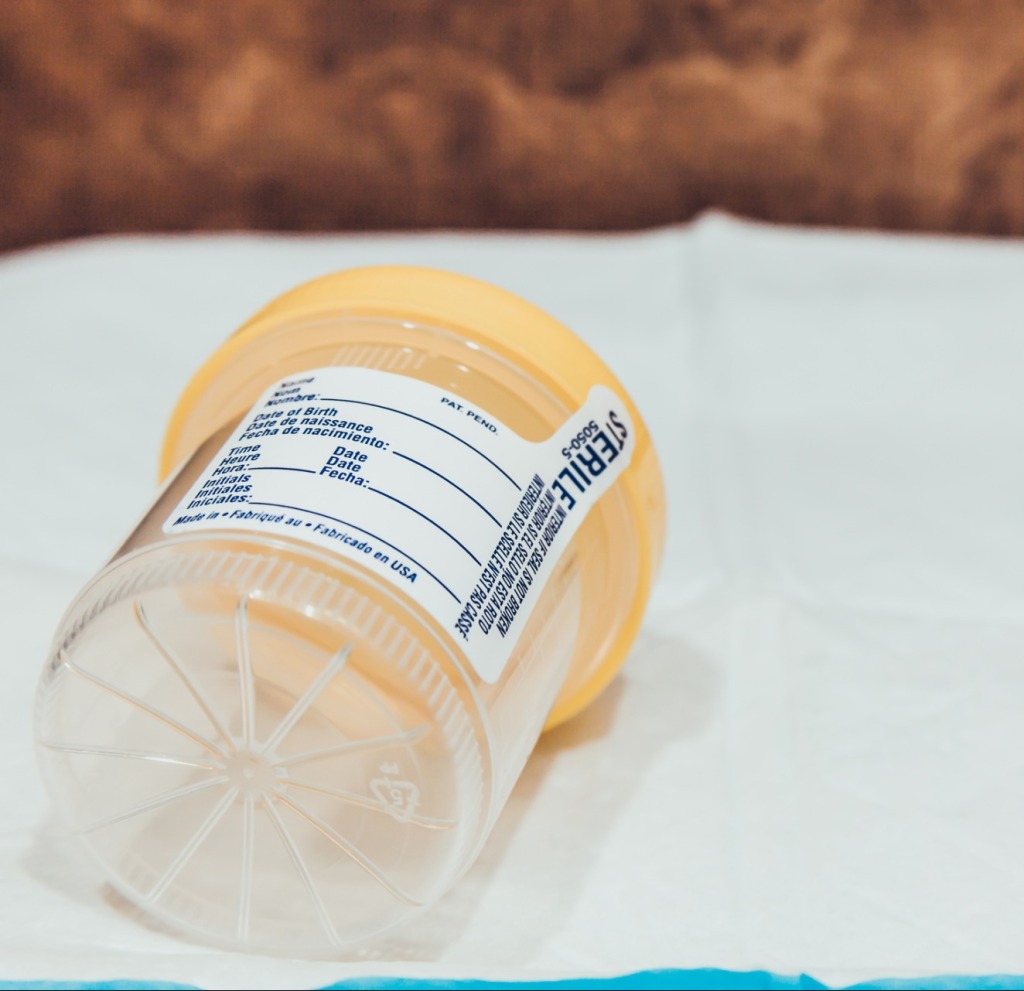 Mobile Drug Testing Services | DOT & Non-NOT Drug Testing